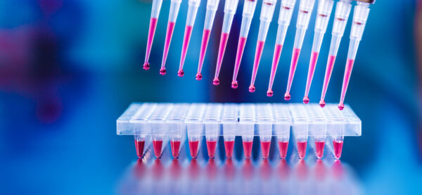 What is Matrix Interference and How Does It Affect Testing? – Arbor Assays